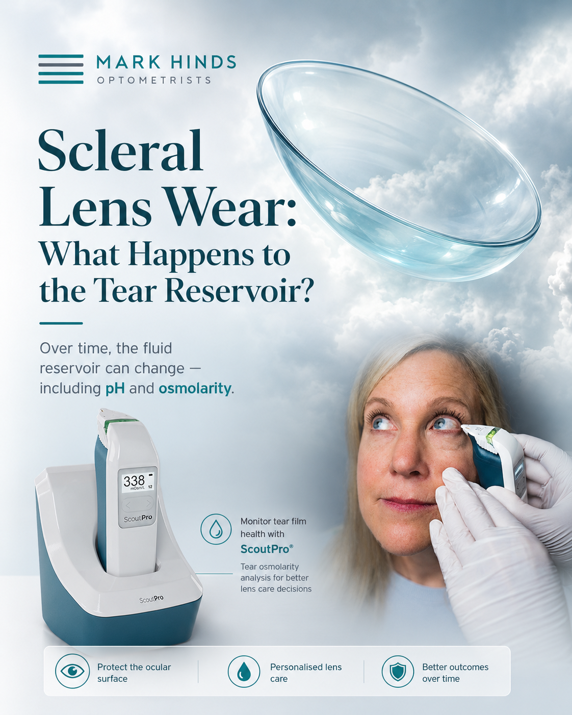 Scleral Contact Lens Fog - Mark Hinds
